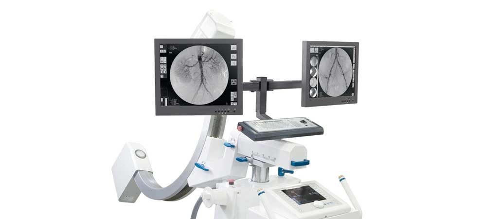 Moonray COMPACT high technology c-arm made in Italy - SIMAD
